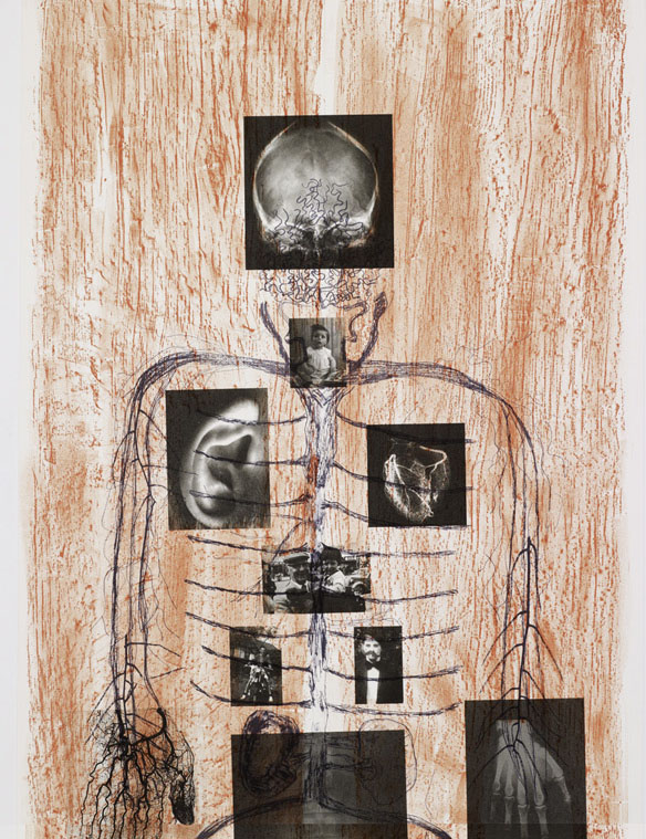 Reassembling the Self | Susan Aldworth | Museum van de Geest